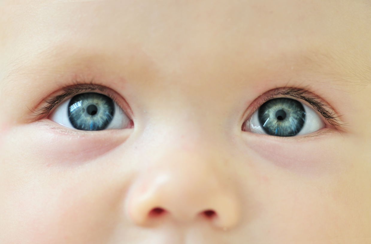 Six Eye-related Diseases that Children are Vulnerable Too - Bragging Mommy