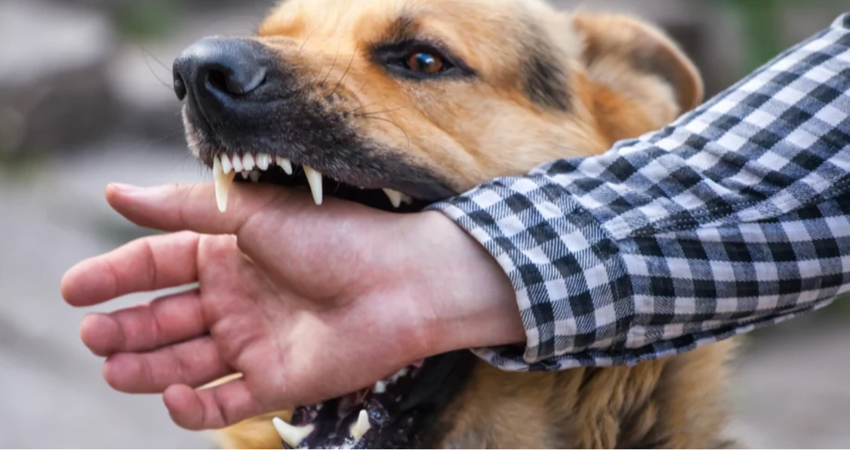 First Aid Tips for an Animal Bite - Bragging Mommy