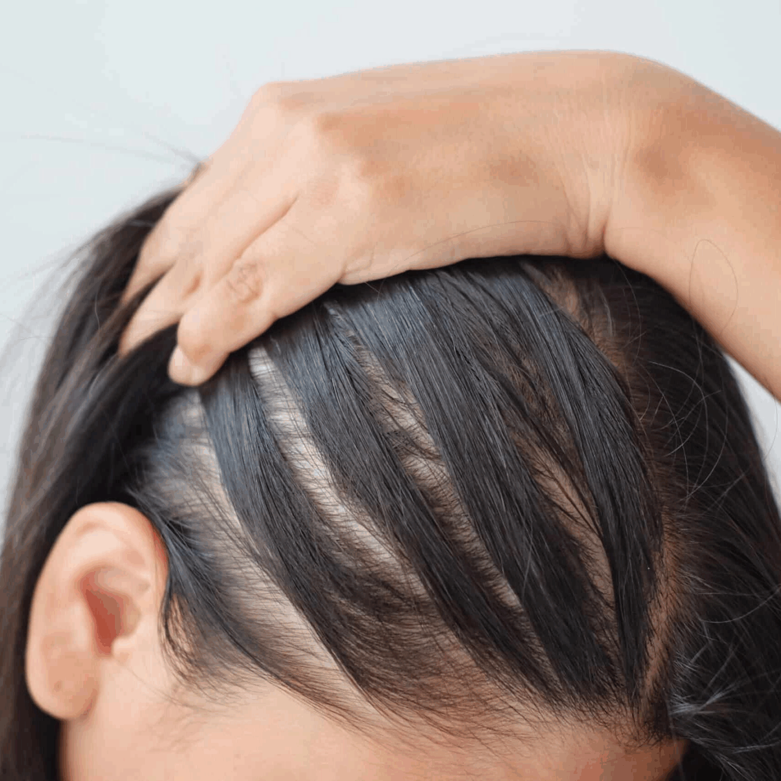 When to Worry About Hair Loss: Signs You Shouldn’t Ignore - Bragging Mommy