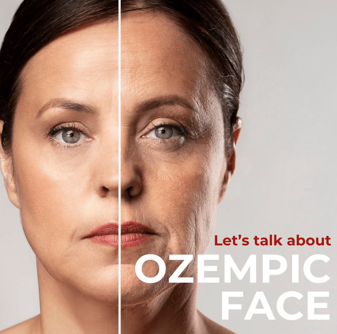 What is 'Ozempic face' and how do you avoid it? - Bragging Mommy